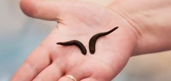 Piócás kezelés Budapest - Orvosi pióca terápia